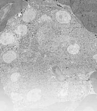 FAST-EM | Ultra-fast automated multibeam electron microscope